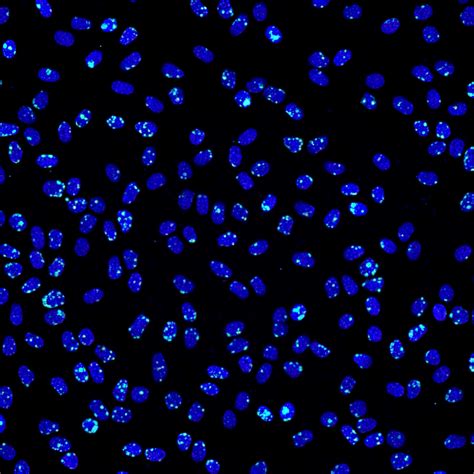 Ai Generated Image Detection A Leap In Scientific Integrity
