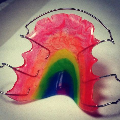 Retainer Designs And Colors