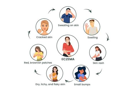 Types Of Eczema