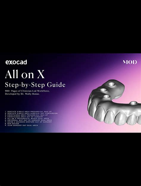 Exocad All On X Step By Step Guide The MOD Institute