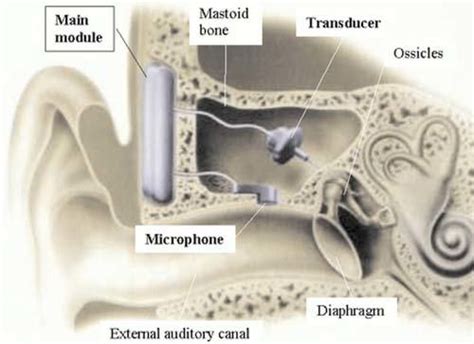 Totally Integrated Cochlear Amplifier Source Download Scientific