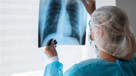 The Root Causes Of Pleural Disorders Explained Fordsparein