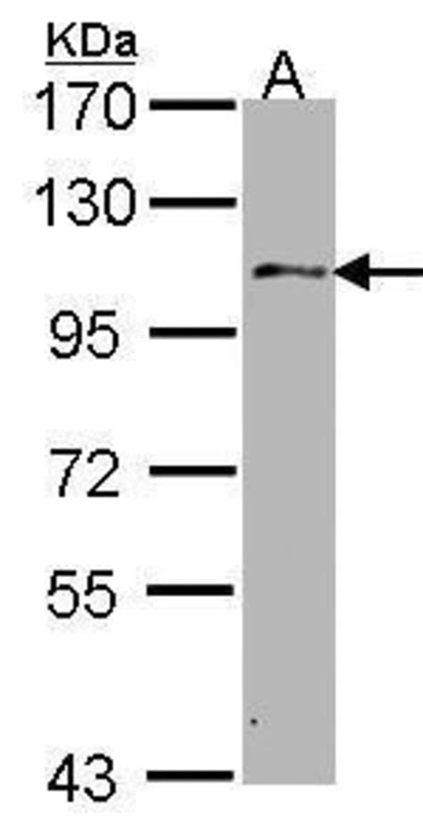 Invitrogen Usp10 Polyclonal Antibody 100 μl Unconjugatedantibodies