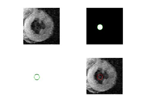 Image Segmentation Seqamlab