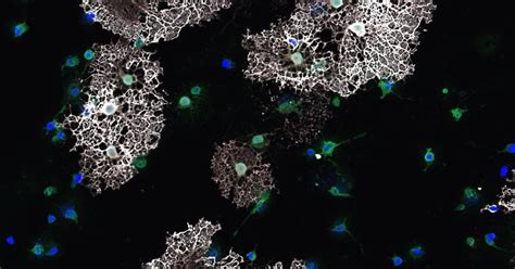 Snapshot What Are Oligodendrocytes National Ataxia Foundation