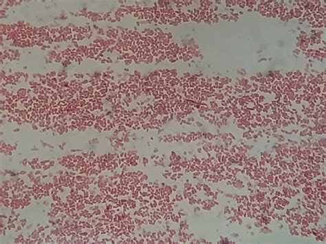 Proteus Penneri Introduction Morphology Pathogenicity Lab Dia