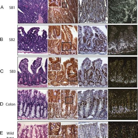The Adenomatous Polyposis Coli Apc Mutation Spectrum Varies With