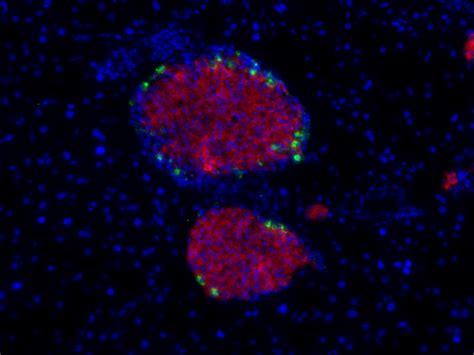 Gentle Islet Cell Transplant Cures Mice Of Diabetes With Few Side