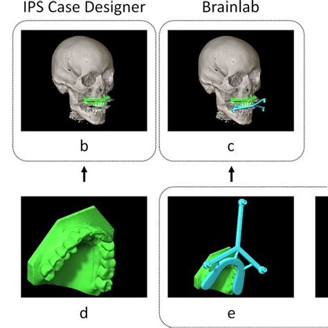 Workup Of The Registration Free Workflow And Software Used The Ct Scan