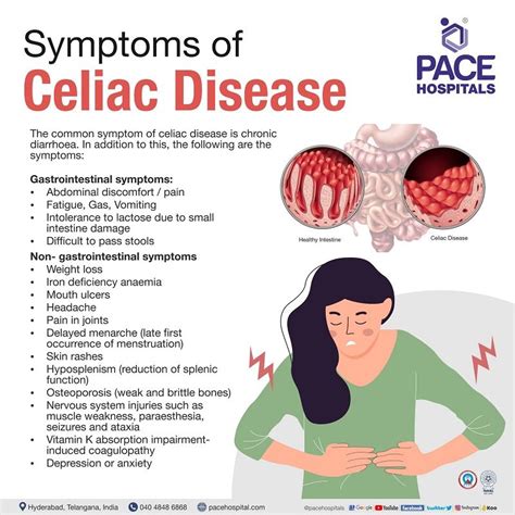 Celiac Disease And Colonoscopy Prep At Emily Jenkins Blog