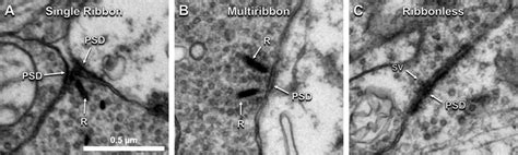 Structural Motifs Of Excitatory Synapses In The Mammalian Retina Range Journal Of