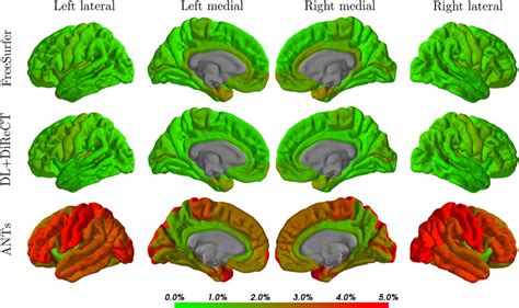 Color‐coded Reproducibility Errors Of The Roi‐wise Average Cortical Download Scientific Diagram