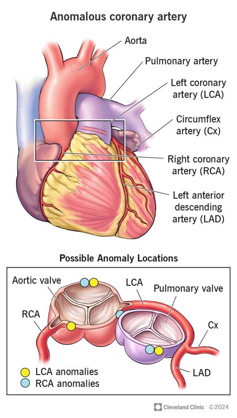 Circumflex Artery Is Part Of