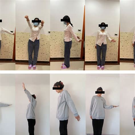 Postoperative Functional Photographs Of Two Typical Patients A Download Scientific Diagram