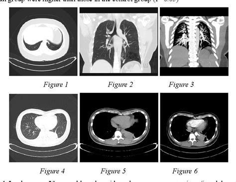 Figure 4 From Clinical Value Of Enhanced Ct In The Diagnosis Of Pulmonary Sequestration