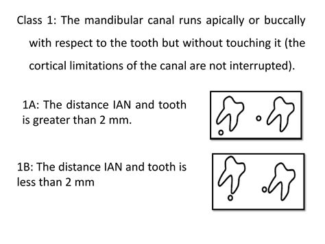 Third Molar Impaction Basic Pptx Third Molar Impaction Basic Pptx