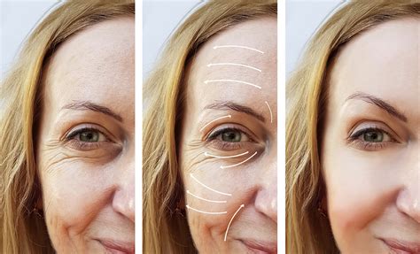 Wrinkles Vs Proportions And Harmony