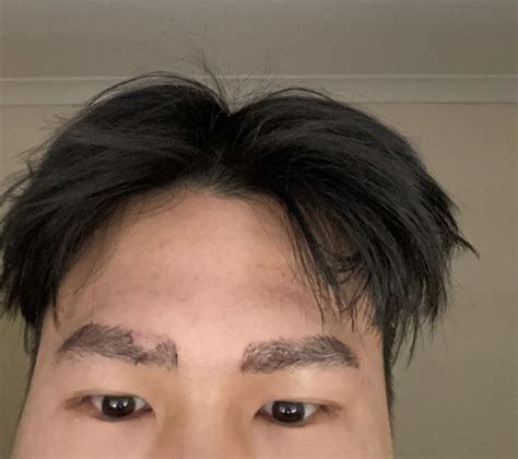 Scabbing After Day3 Chunks Falling Off R Microblading
