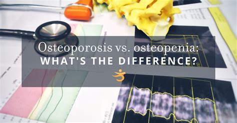 What Is The Difference Between Osteopenia And Osteoporosis Bb