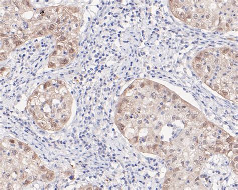 P16ink4a Mouse Monoclonal Antibody A4a3 Ha600027 Huabio