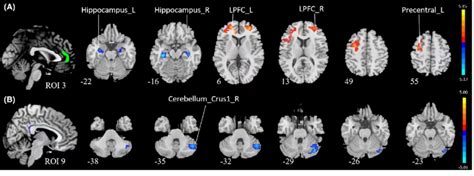 Resting State Fc Differences In The Cingulate Subgroups Between The