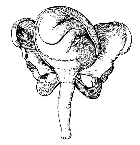 Shoulder Presentation