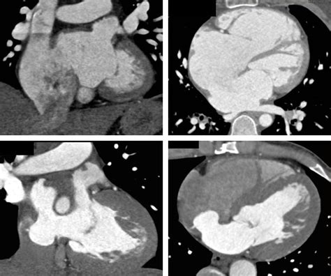 Ct Quick Guides Ct Scanning