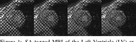 Figure 1 From Mri Image Enhancement A Pde Based Approach Integrating