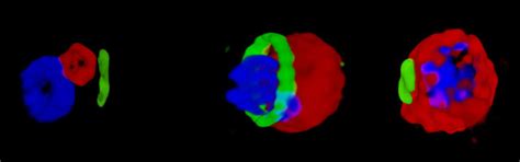 Imagerie Scientifique Le Paludisme Au Microscope Le Blob Lextra Média