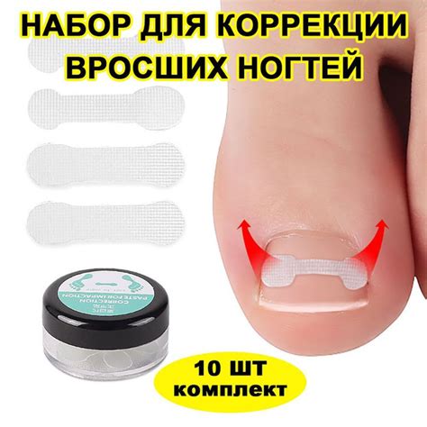 Средство тампонада наклейки тейпы для коррекции вросших ногтей 10шт ...