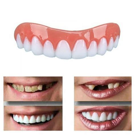 Temporary False Teeth