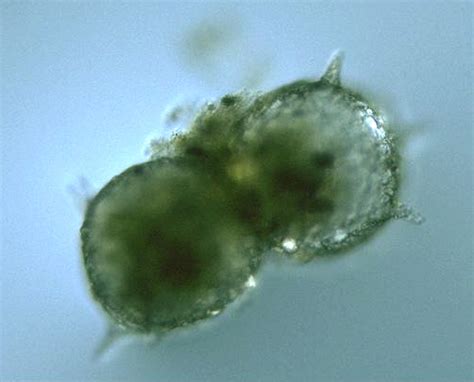 Protist Images Difflugia Corona