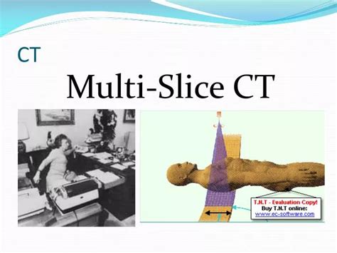 Ppt Multi Slice Ct Powerpoint Presentation Free Download Id 5573730
