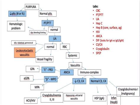 Vasculitis An Approach Pptx