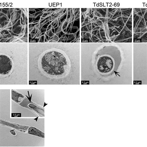 ultrastructural characteristics of the cpslt2 null mutant strain