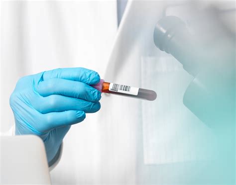 Indium Labelled Wbc Scan