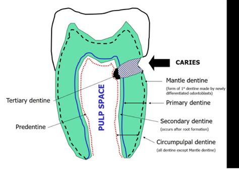 Structure Of The Dentine Pulp Complex Flashcards Quizlet