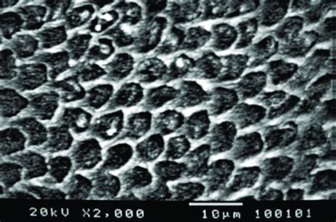 Types Of Enamel Etching Patterns At Lori Mercado Blog