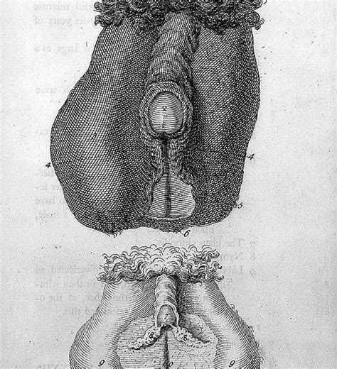 Anatomy Of A Hermaphrodite Female Clitoral Anatomy Framed Print By