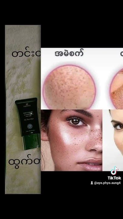 အမဲစက်တင်းတိတ်သမားများမှဲ့ခြောက်သမားများအရမ်းကိုသုးံလို့ကောင်းတဲ့setလေးပါရှင့် Youtube