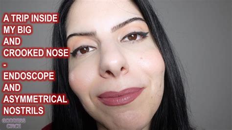 A Trip Inside My Big And Crooked Nose Endoscope And Asymmetrical