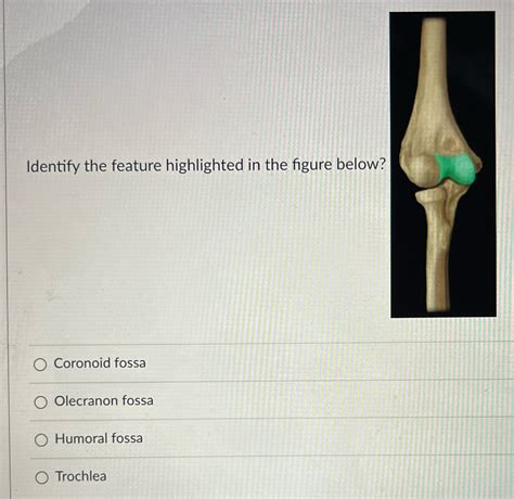 [solved] Identify The Feature Highlighted In The Figure Below O Coronoid Course Hero