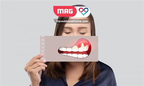 عفونت دندان چیست؟ علائم و روش درمان