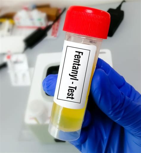 Premium Photo Urine Sample For Fentanyl Drug Test