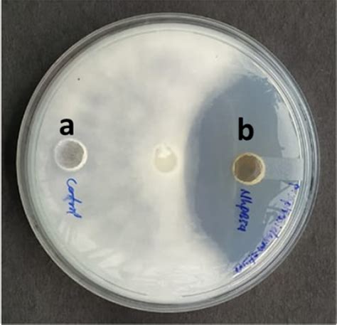 Antifungal Activity Of Extract Prepared From Nhpb54 Against Pythium