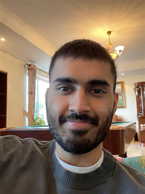 1 Year Mewing Transformation 20 To 21 R Mewing