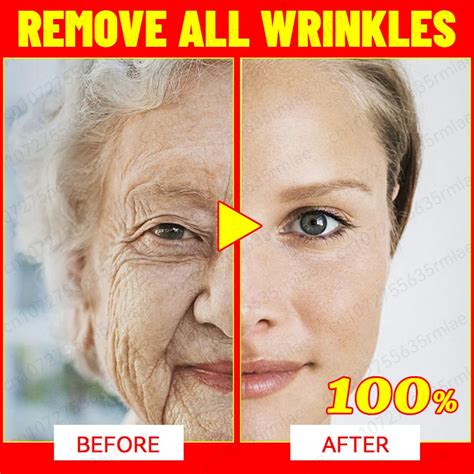 효과적인 안티에이징 및 주름 방지 페이셜 세럼 얼굴 주름 제거 눈 주위 잔주름 제거 까마귀 발 목 주름