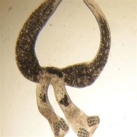 Female Ergasilus Sp X40 Original Download Scientific Diagram