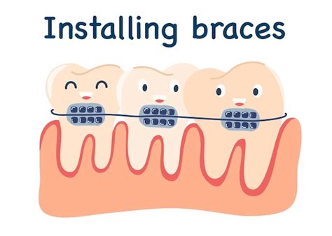 Premium Vector 0127 Braces