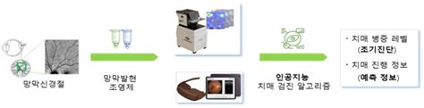 Ai기반 알츠하이머 조기 진단기기 개발기업 자이온프로세스 시드투자 유치 플래텀